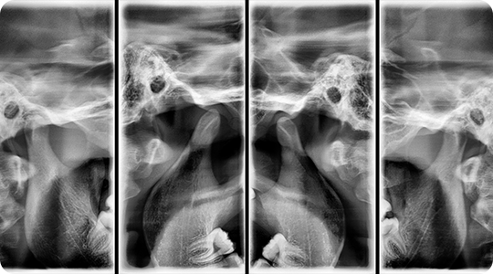 Radiografías Dentales en Monterrey - RADIOBEAM